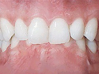 Common Orthodontic Problems - Masri Orthodontics : Get the Smile You ...